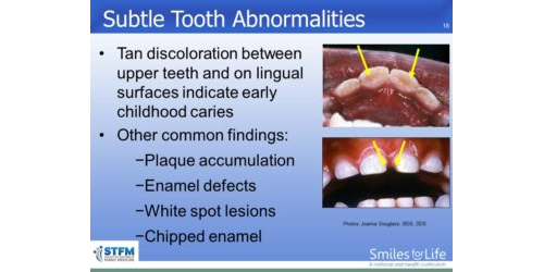 Download Slides - Module 7: The Oral Exam | Smiles for Life Oral Health