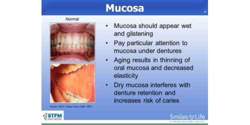 Download Slides – Module 8 Geriatric Oral Health | Smiles for Life Oral ...